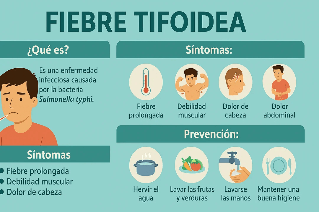 «Alerta por brote de fiebre tifoidea en Argentina: síntomas, prevención ...